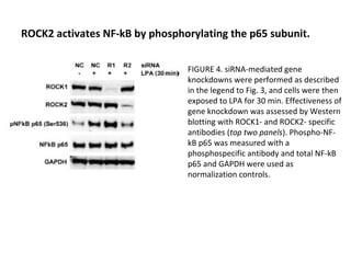 Presentation Rho Kinase-2 Activation in HUVEC111 | PPT