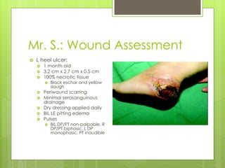Giving SBAR Report | PDF