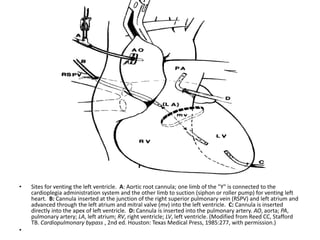 CARDIO PLEGIA DELIVERY DR NIKUNJ R SHEKHADA (MBBS,MS GEN SURG,DNB CTS ...