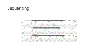 Retinal Dystrophies and CRB1 | PPTX