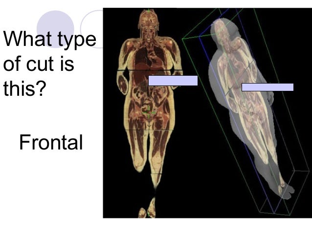 Chapter 1 Notes Intro To Anatomy And Physiology chapter-1-notes-intro-to-anatomy-and-physiology