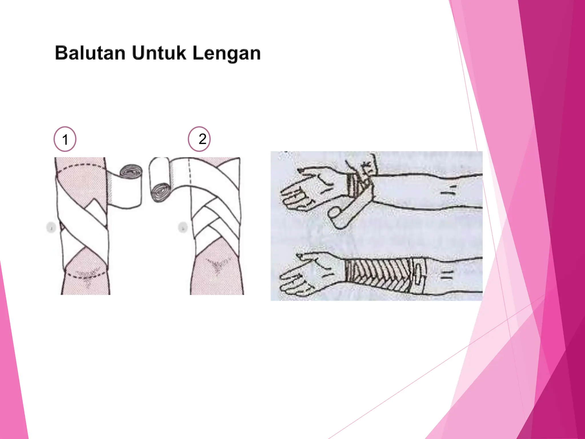 BAB 1 BEBATAN DAN BALUTAN DALAM PERTOLONGAN CEMAS | PPT