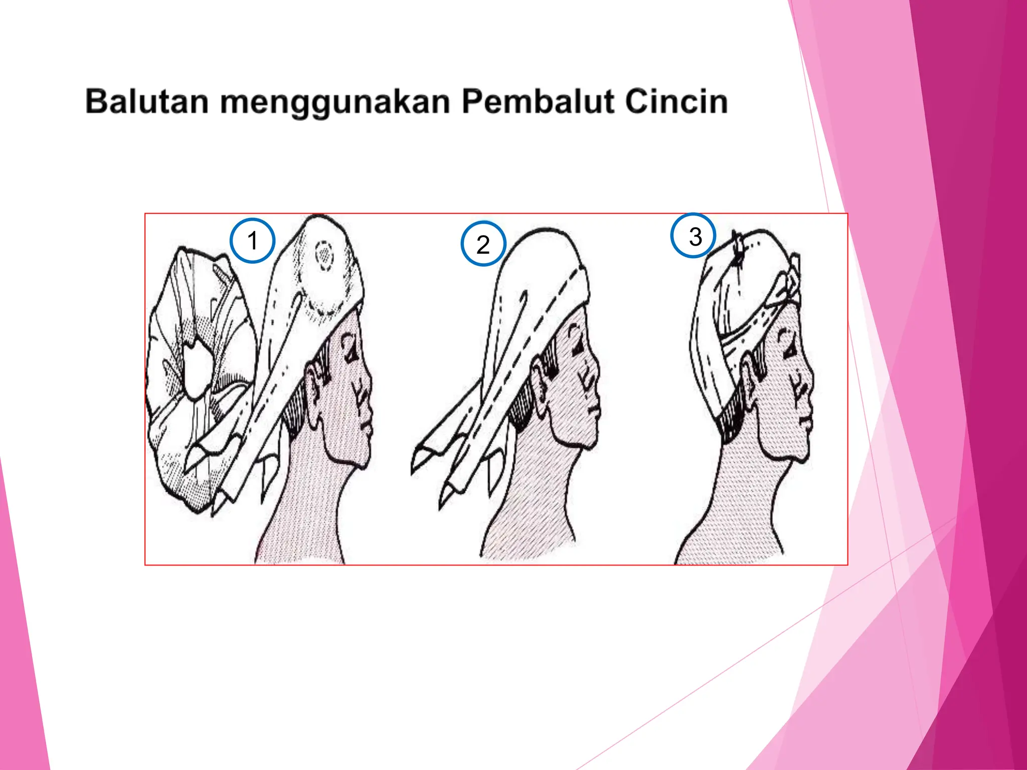 BAB 1 BEBATAN DAN BALUTAN DALAM PERTOLONGAN CEMAS | PPT