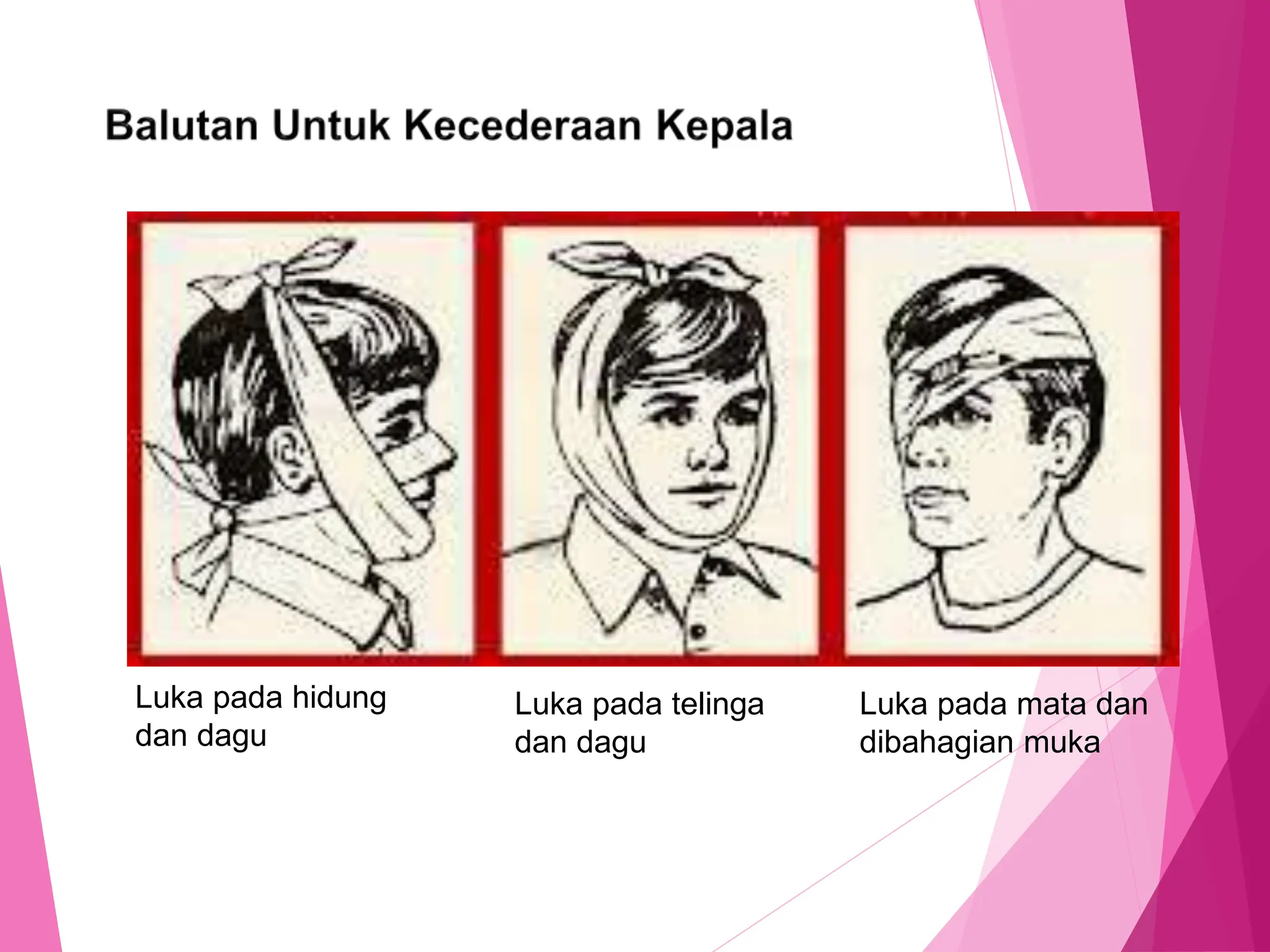 BAB 1 BEBATAN DAN BALUTAN DALAM PERTOLONGAN CEMAS | PPT