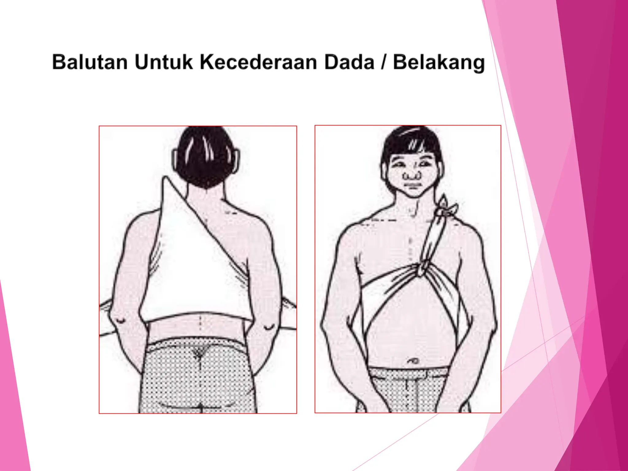 BAB 1 BEBATAN DAN BALUTAN DALAM PERTOLONGAN CEMAS | PPT