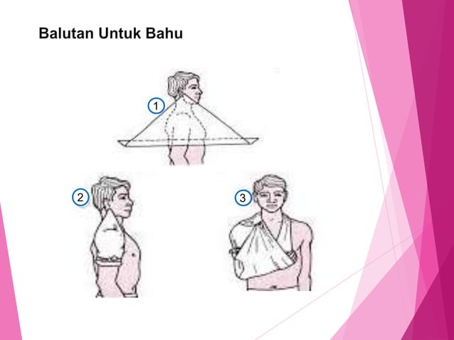 BAB 1 BEBATAN DAN BALUTAN DALAM PERTOLONGAN CEMAS | PPT