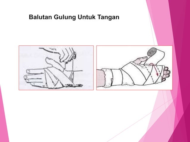 BAB 1 BEBATAN DAN BALUTAN DALAM PERTOLONGAN CEMAS | PPT