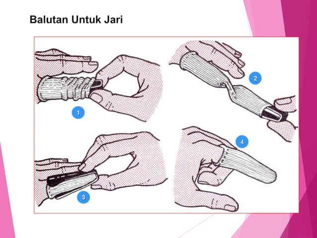 BAB 1 BEBATAN DAN BALUTAN DALAM PERTOLONGAN CEMAS | PPT