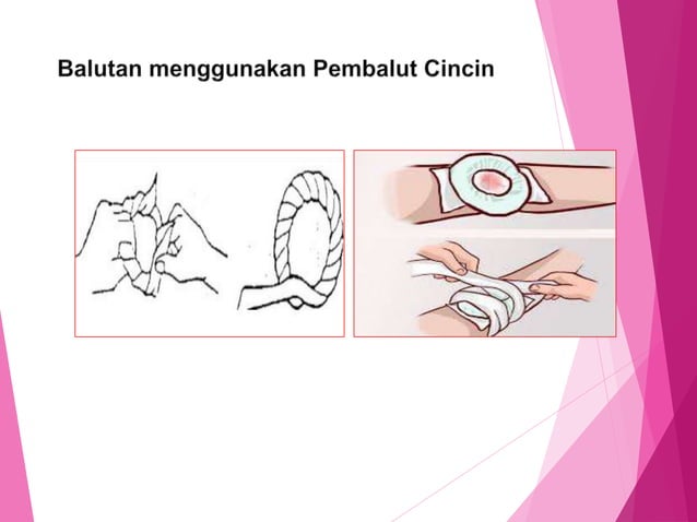 BAB 1 BEBATAN DAN BALUTAN DALAM PERTOLONGAN CEMAS | PPT