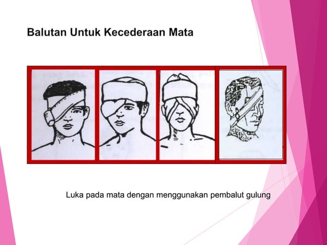 BAB 1 BEBATAN DAN BALUTAN DALAM PERTOLONGAN CEMAS | PPT