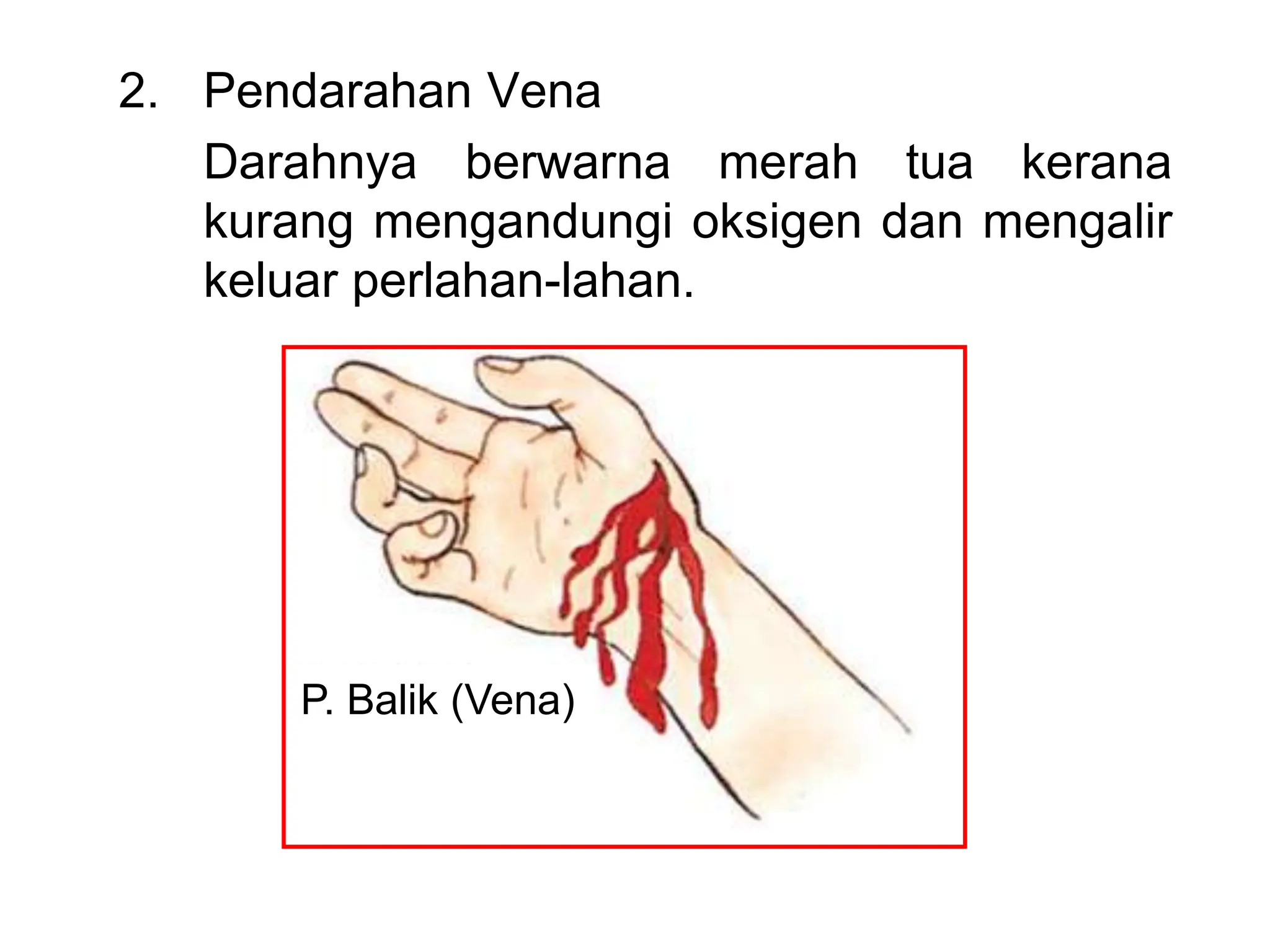 BAB 1 LUKA DAN PENDARAHAN DALAM PERTOLONGAN CEMAS | PPT