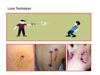 BAB 1 LUKA DAN PENDARAHAN DALAM PERTOLONGAN CEMAS | PPT