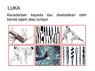BAB 1 LUKA DAN PENDARAHAN DALAM PERTOLONGAN CEMAS | PPT