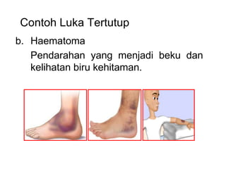 BAB 1 LUKA DAN PENDARAHAN DALAM PERTOLONGAN CEMAS | PPT