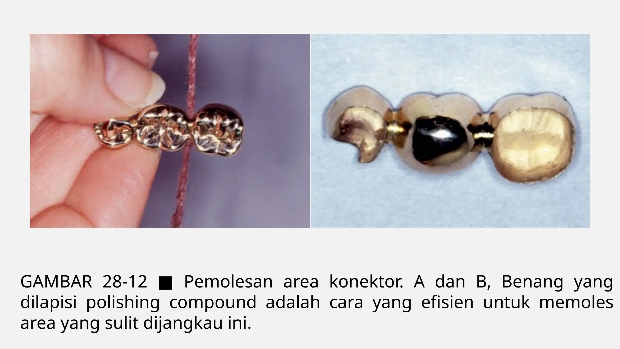 BAB 28.pptx finishising cast crown pada prostodonsia | PPTX