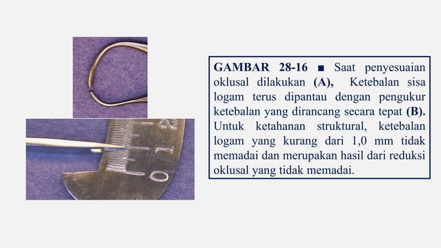 BAB 28.pptx finishising cast crown pada prostodonsia | PPTX
