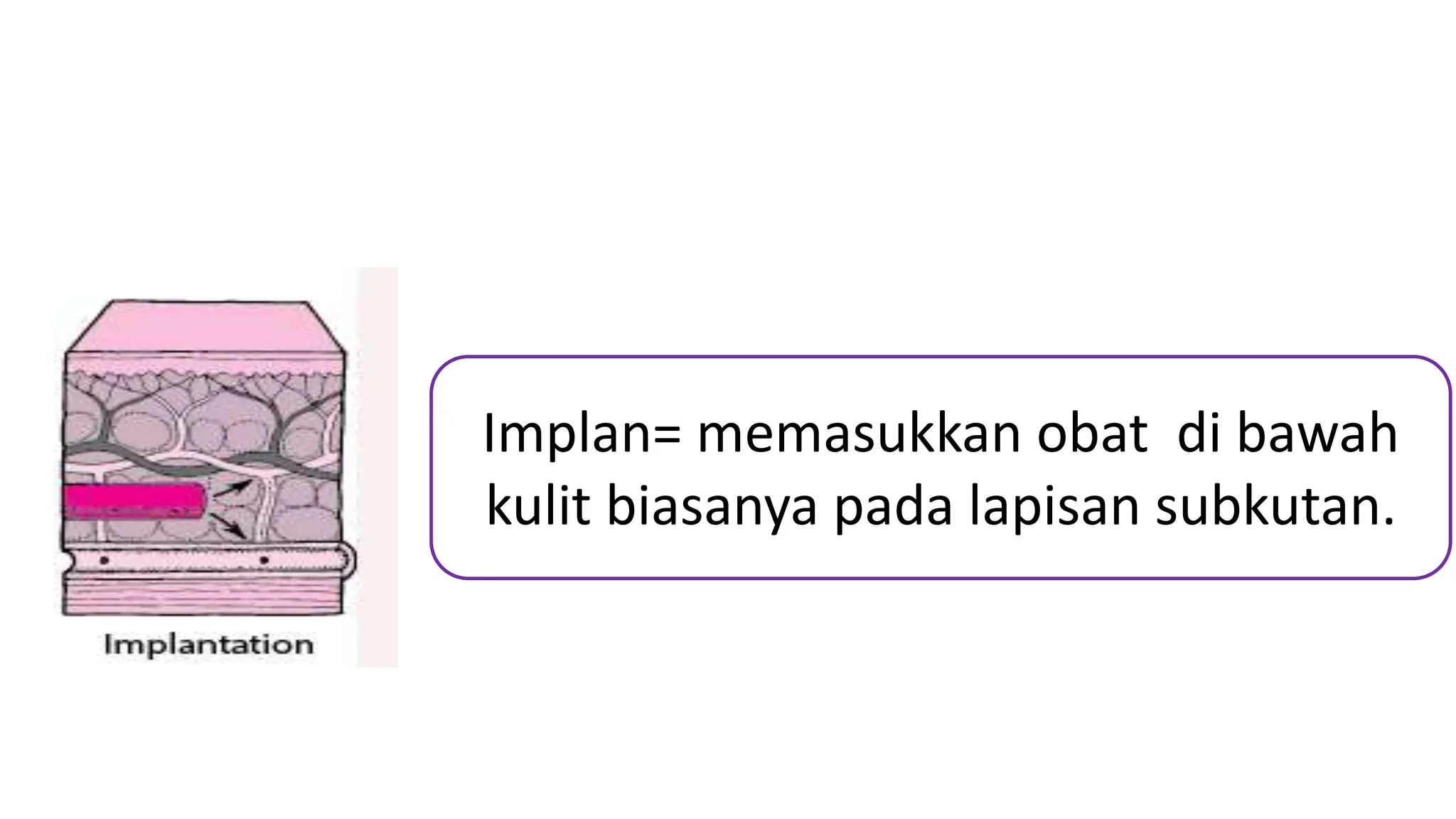 BAB 2 Farmakologi - Cara Pemberian Obat - Copy.pptx