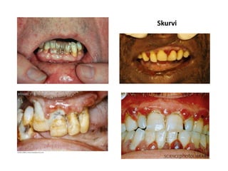 Bab 2 nutrisi | PPTX
