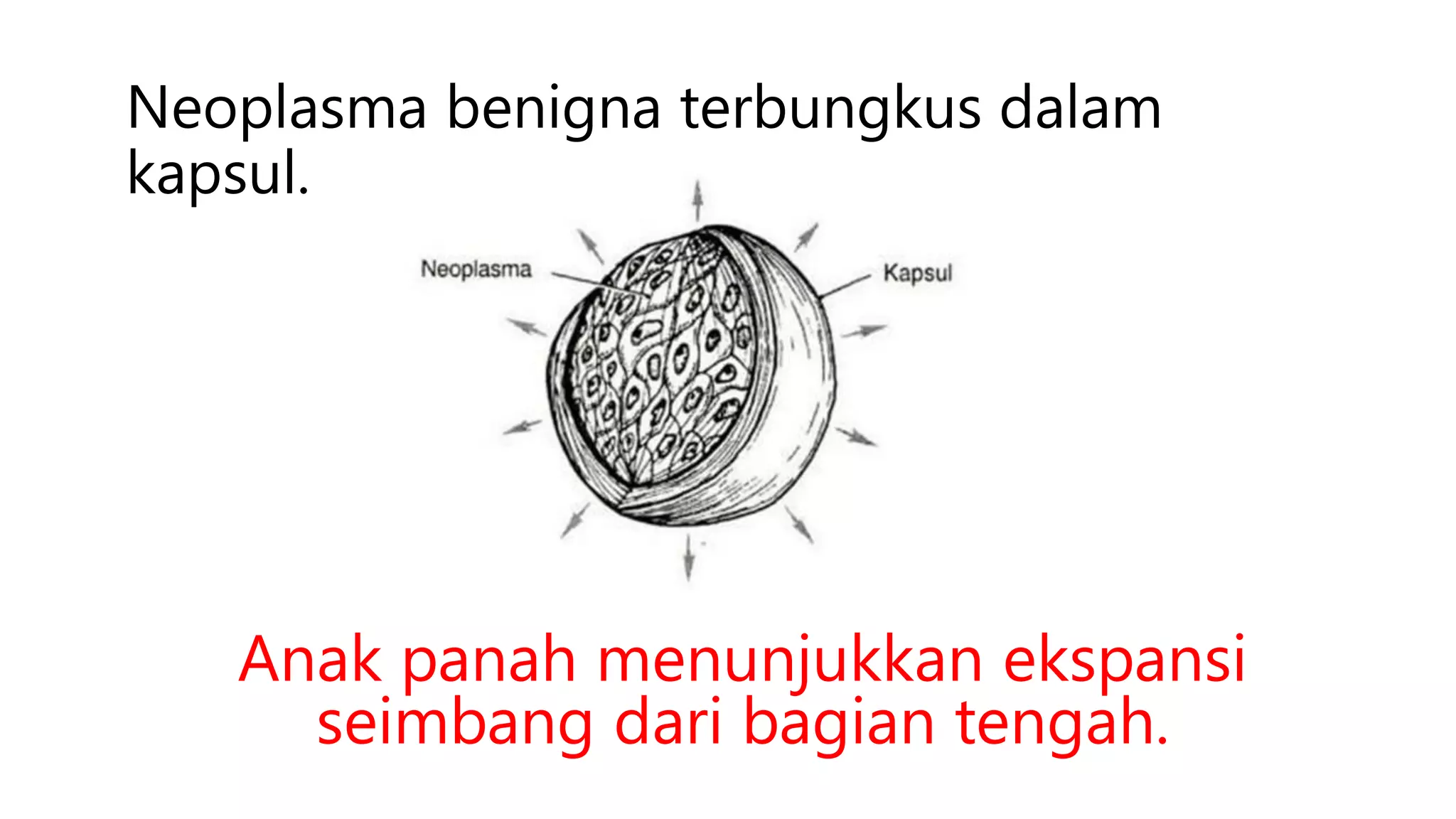Bab 3 konsep dasar neoplasma sesi 1-dr,herlin RMIK POLITEKNIK BAUBAU.pptx