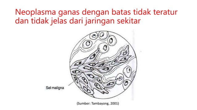 Bab 3 konsep dasar neoplasma sesi 1-dr,herlin RMIK POLITEKNIK BAUBAU.pptx