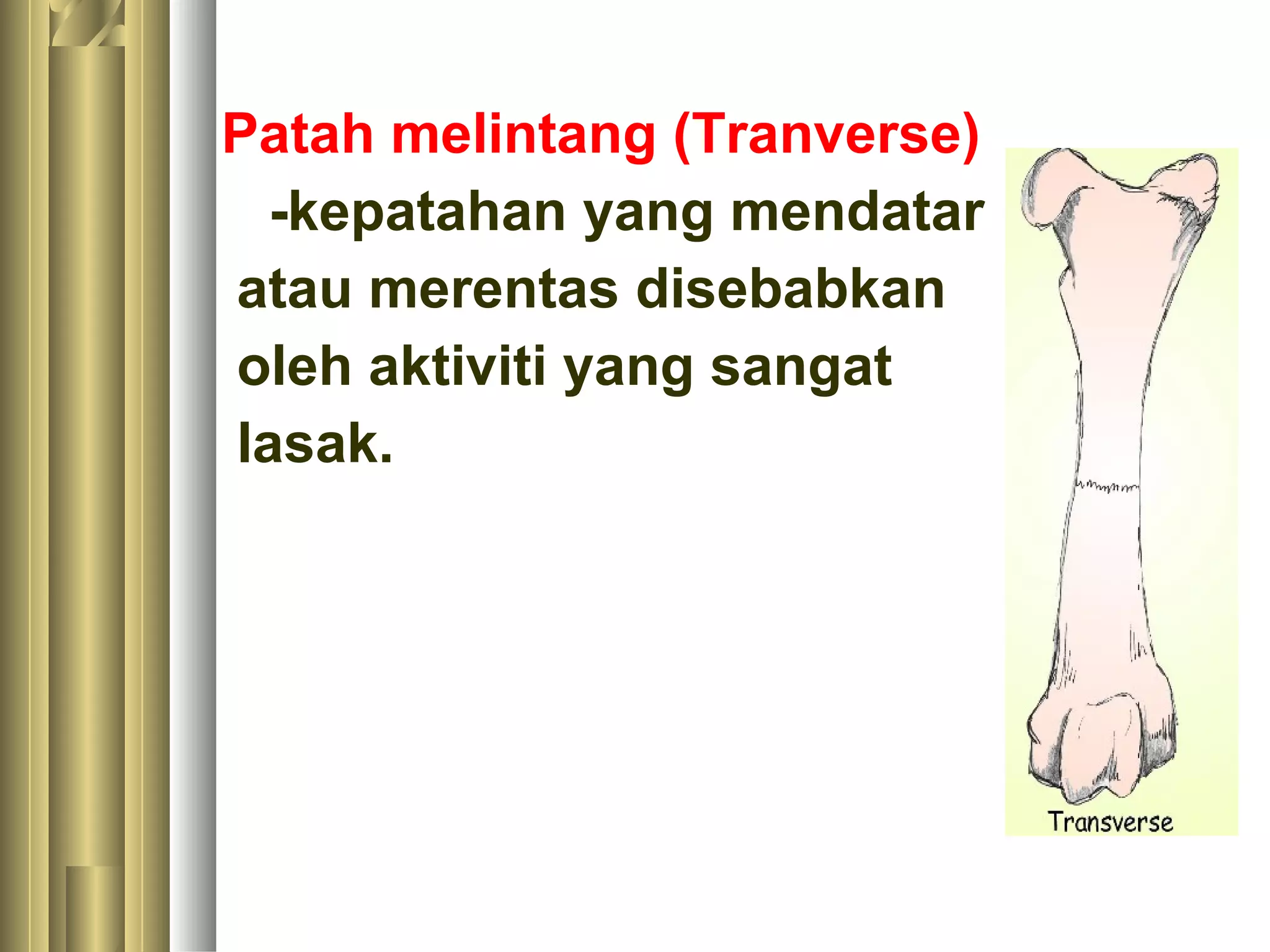 Bab 5 luka & patah | PPT