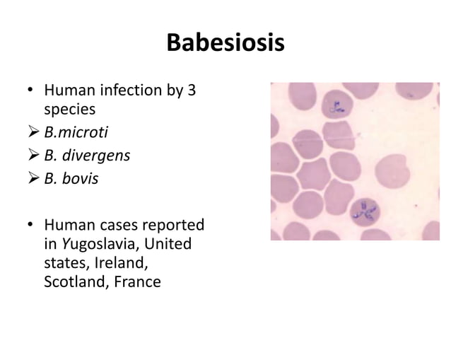 Babesia | PPT
