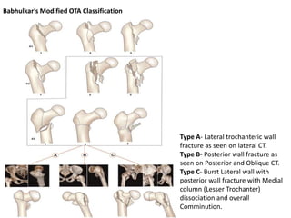 unstable trochanteric fracture | PPTX