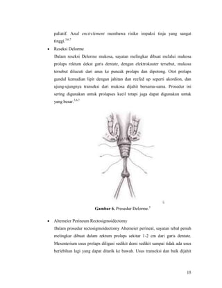 Prolaps Rektum | DOCX