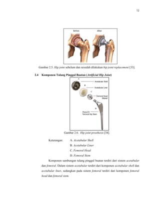 Bab ii -_teori_hip_joint | PDF