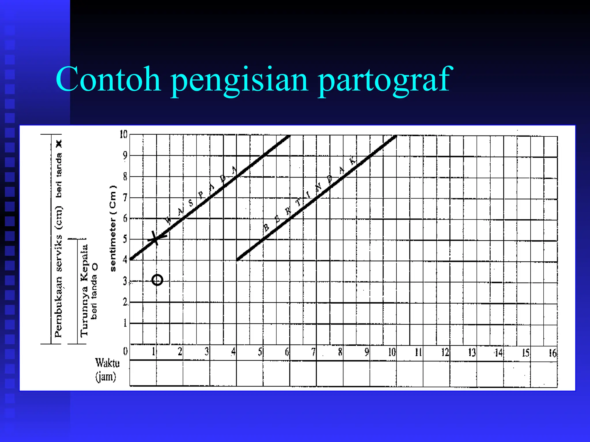 BAB IIa Partograf pada persalinan normal | PPT