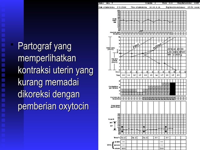 BAB IIa Partograf pada persalinan normal | PPT