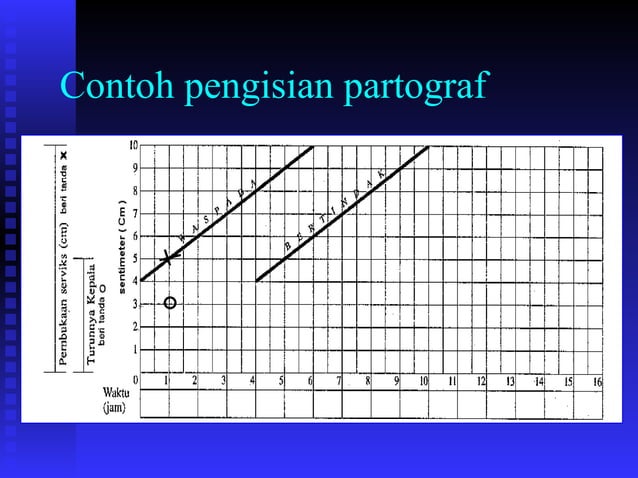 BAB IIa Partograf pada persalinan normal | PPT