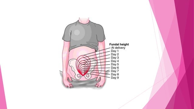 Babinje i anatomske promjene u babinjama | PPT