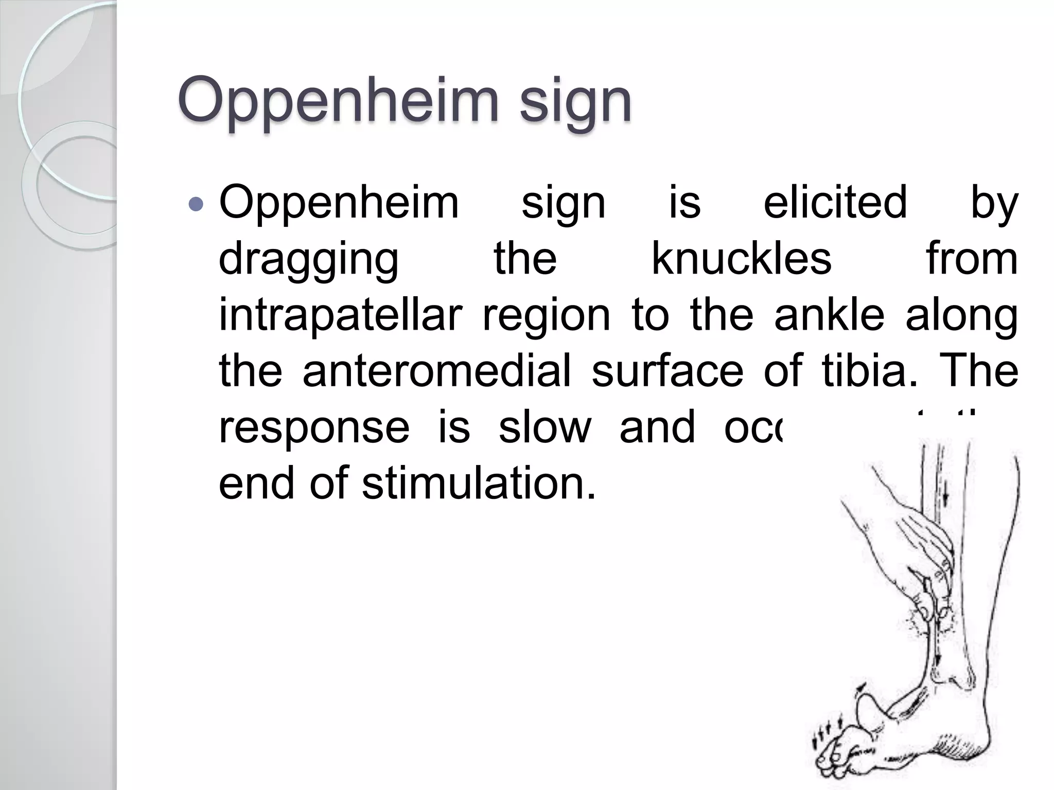 Babinski Sign | PPTX
