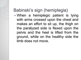 Babinski Sign