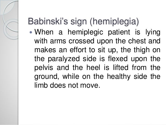 Babinski Sign