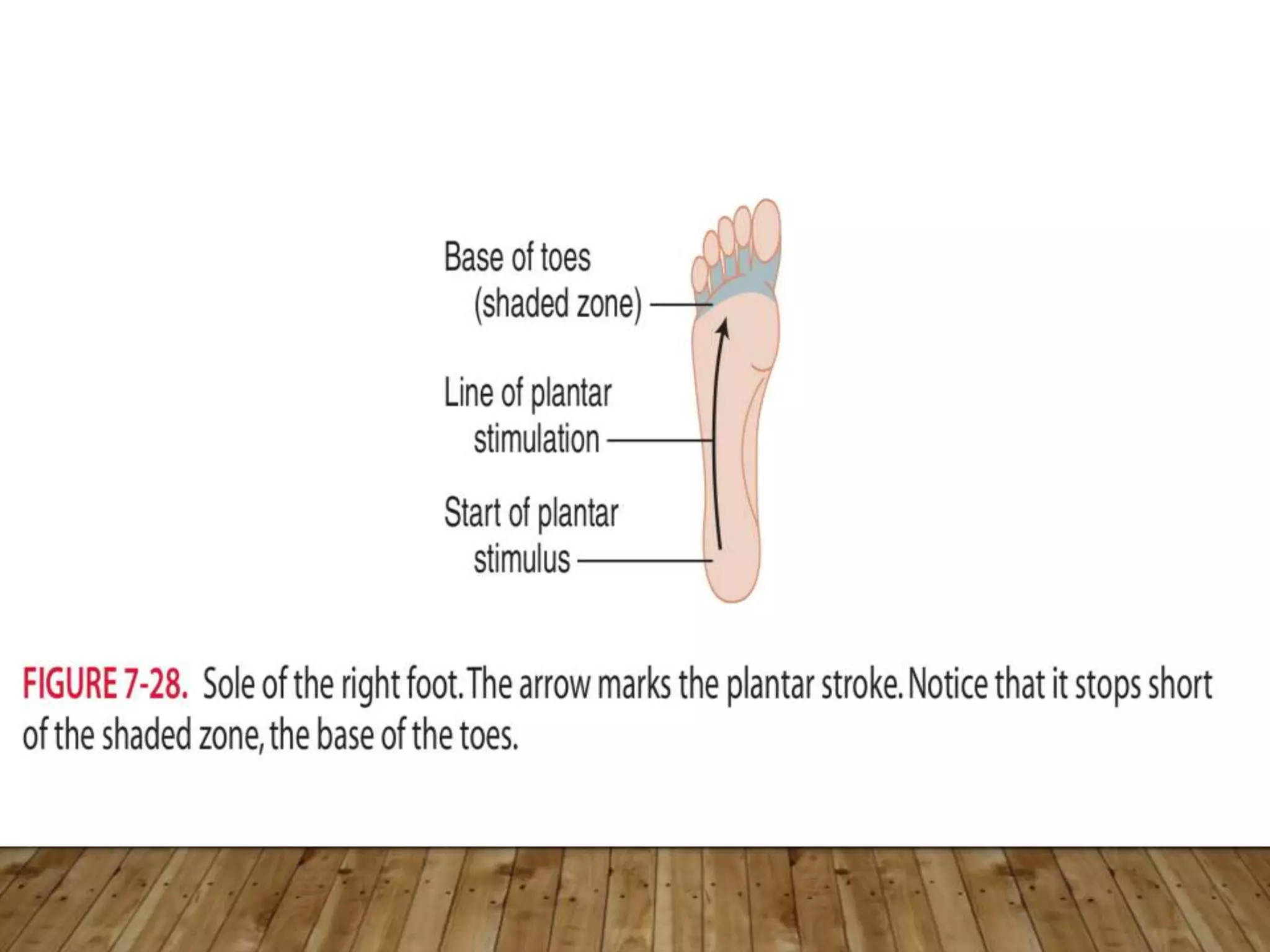 Babinski Sign | PPTX