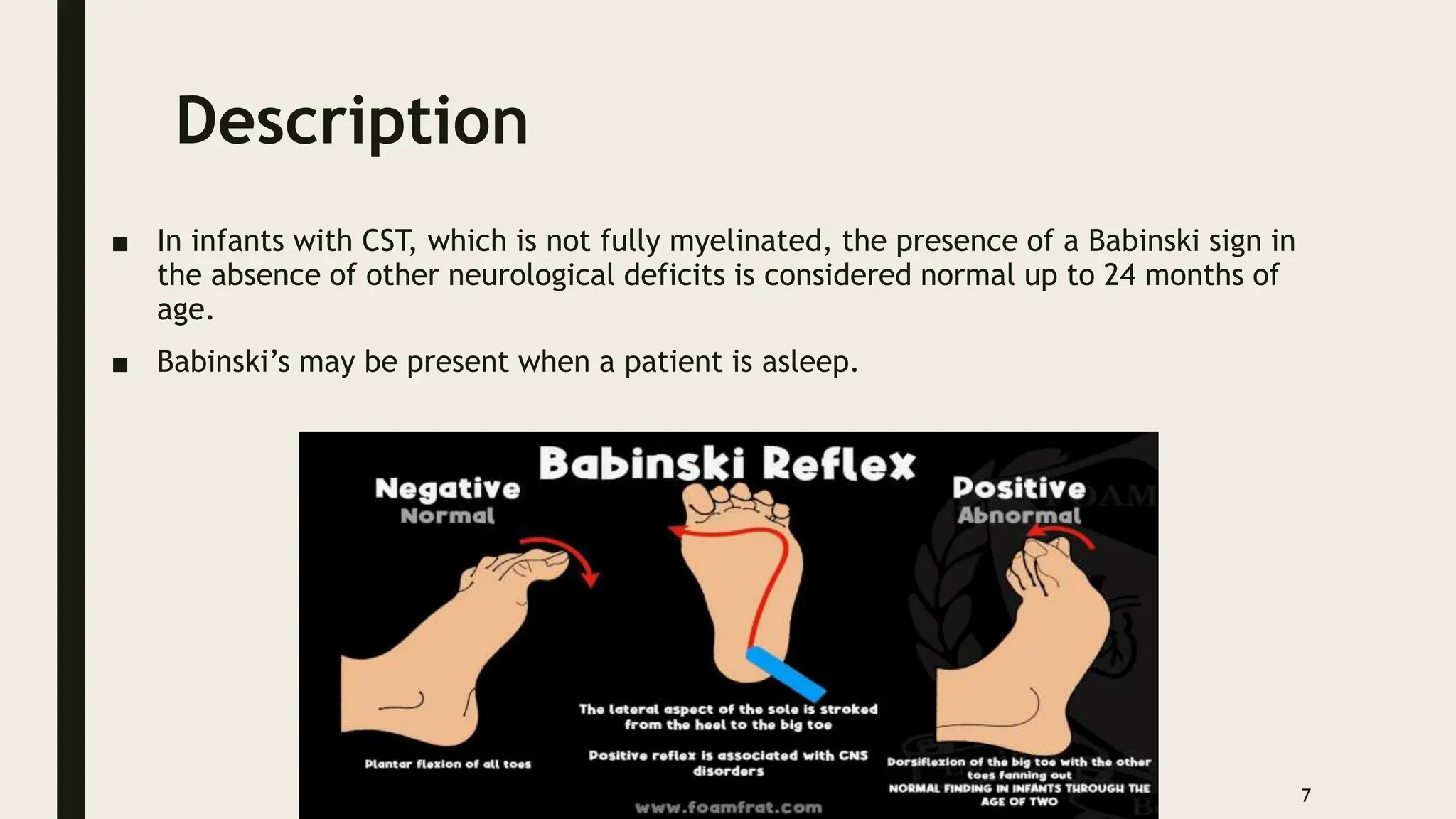 Babinski sign and related signs.pptx | Death, Injury, or Military ...