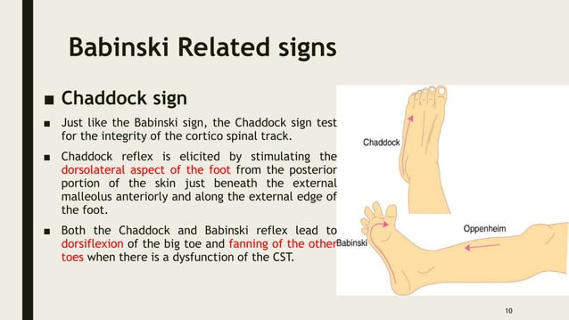 Babinski sign and related signs.pptx | Death, Injury, or Military ...