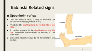 Babinski sign and related signs.pptx | Death, Injury, or Military ...