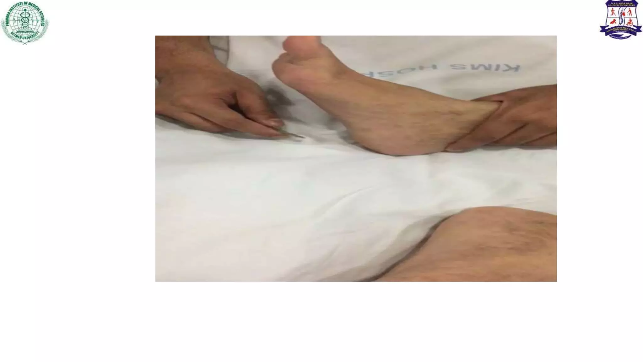 BABINSKI SIGN main.pptx