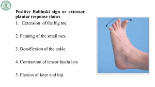 BABINSKI SIGN main.pptx