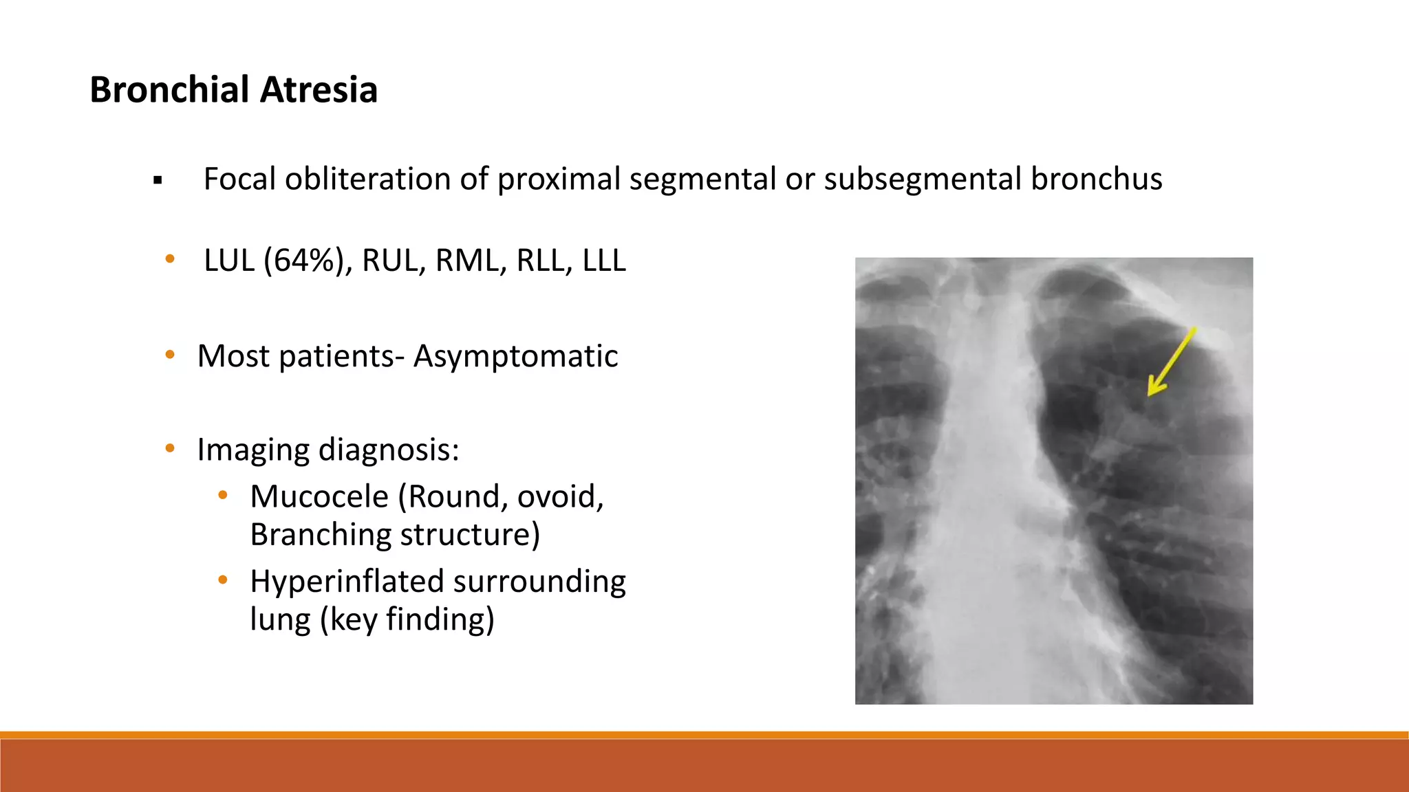 large airway presentation.pptx