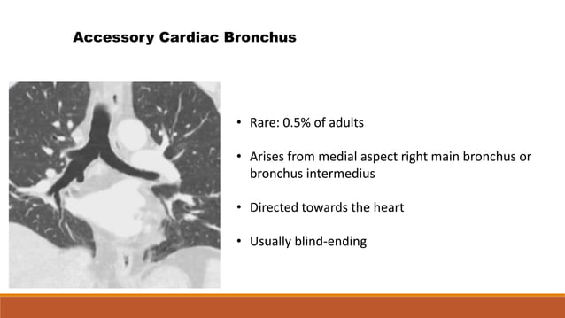 large airway presentation.pptx