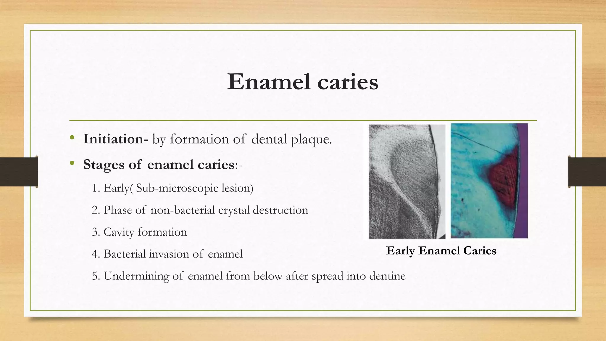 Sequelae of dental caries | PPTX