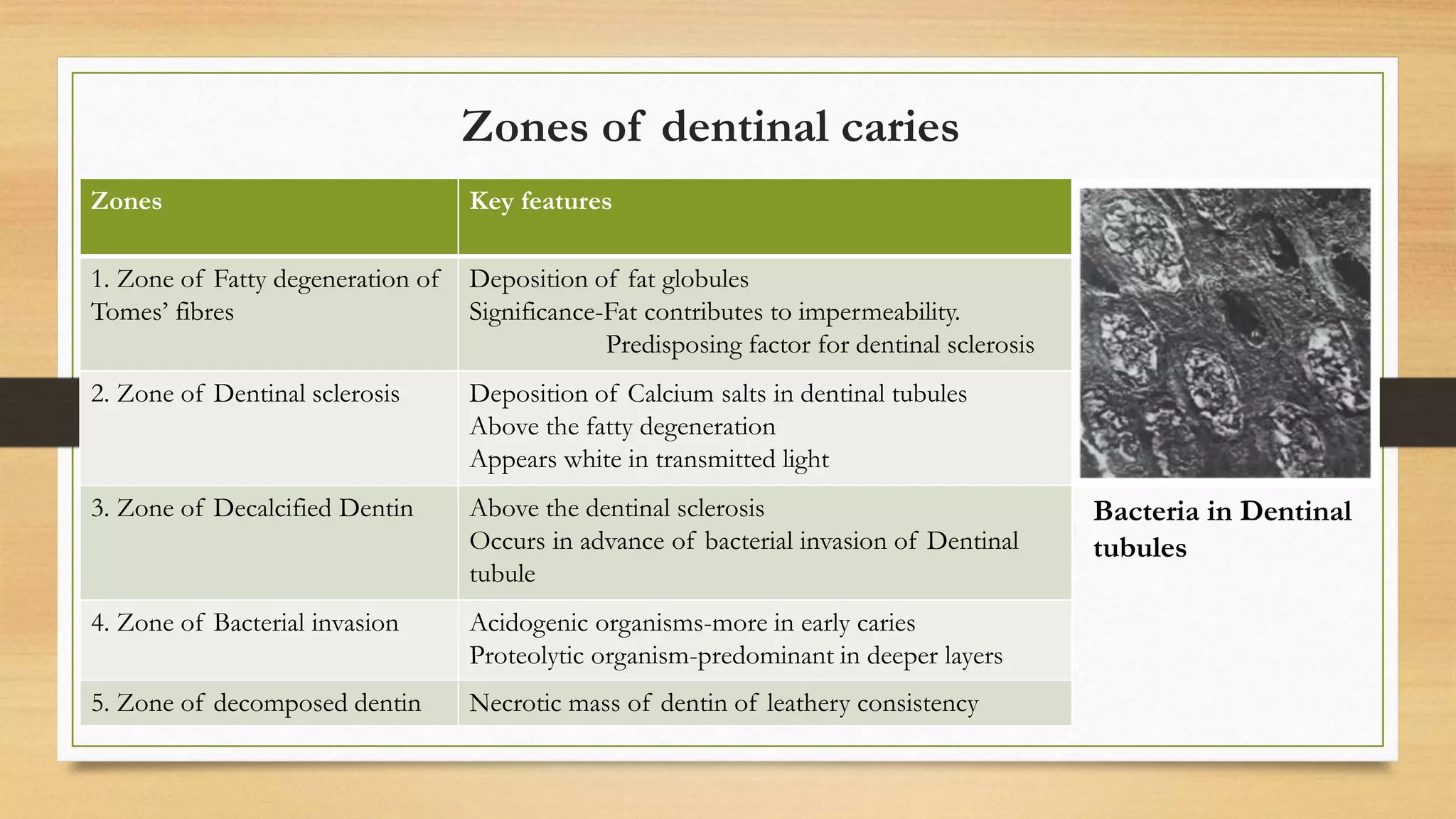 Sequelae of dental caries | PPTX