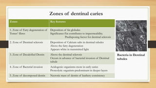 Sequelae of dental caries | PPTX