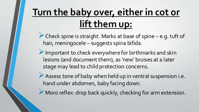 Baby check at birth and 6 weeks | PPTX