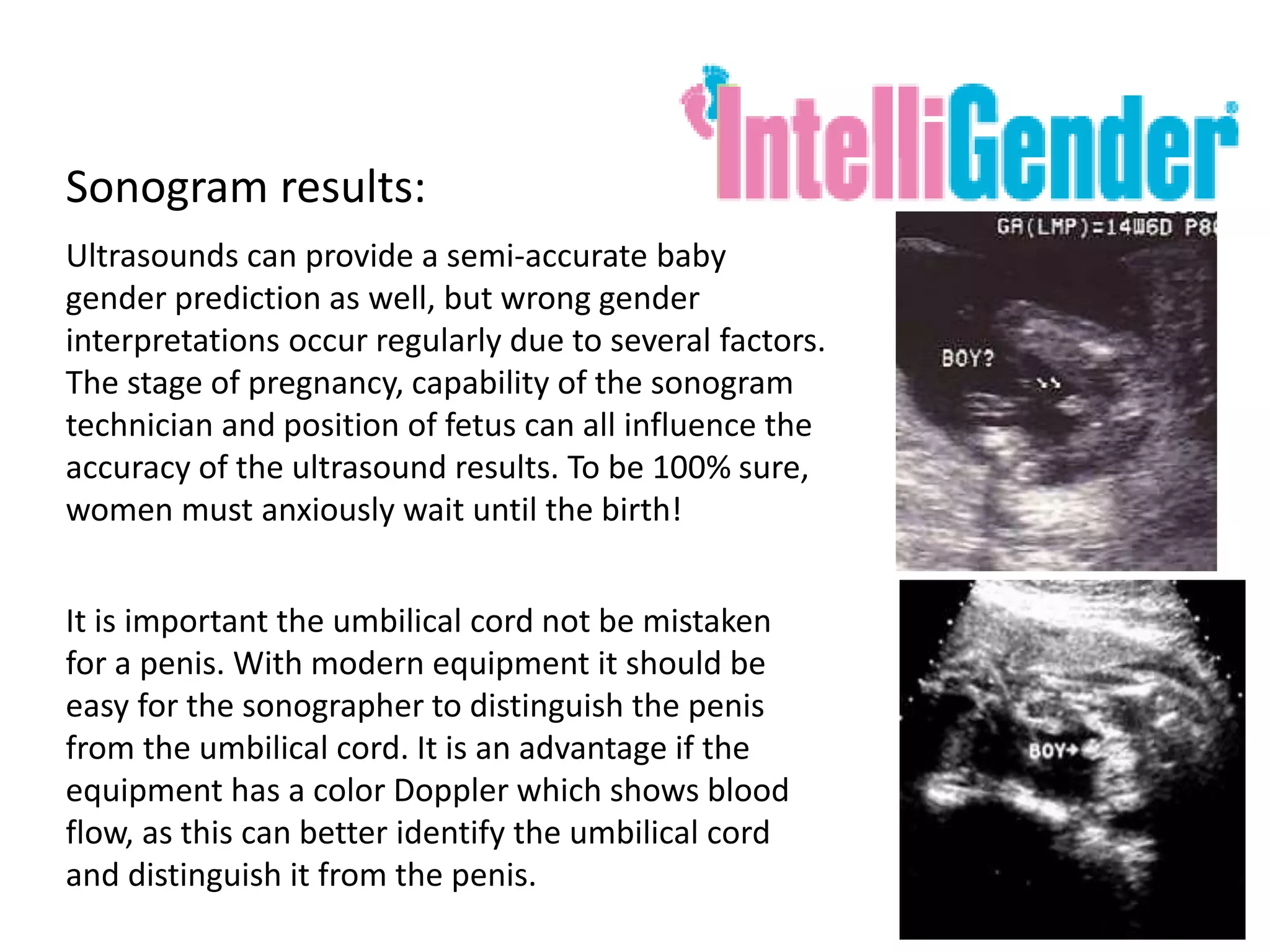 Baby gender predictor boy or girl | PPTX