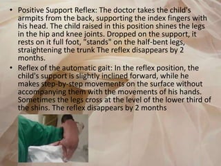 Reflexes of Newborns | PPTX